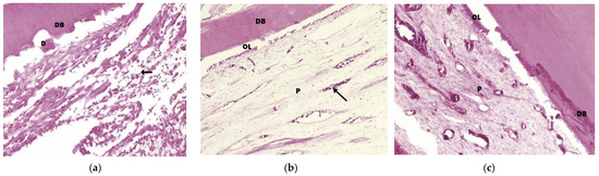 Assessment of Pulpal Status in Primary Teeth Following Direct Pulp ...