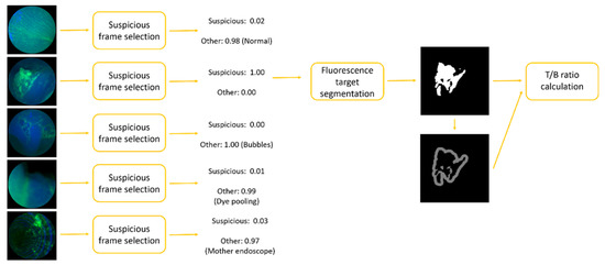 Deep-Learning-Based Real-Time and Automatic Target-to-Background Ratio ...