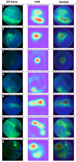 Diagnostics | Free Full-Text | Deep-Learning-Based Real-Time and Automatic Target-to-Background ...