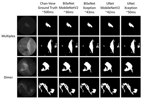 Deep-Learning-Based Real-Time and Automatic Target-to-Background Ratio ...