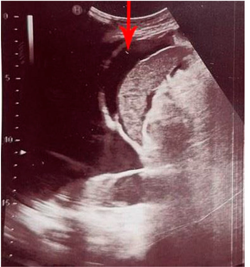 Diagnostics | Free Full-Text | Point-of-Care Abdominal Ultrasonography ...