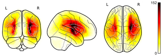 Automatic Segmentation and Quantitative Assessment of Stroke Lesions on ...