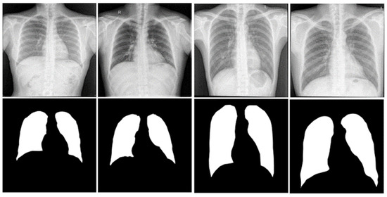 Diagnostics | Free Full-Text | Segmentation-Based Classification Deep Learning Model Embedded ...