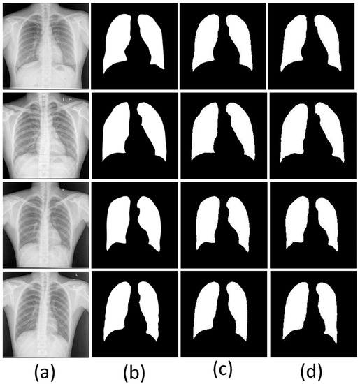 Segmentation-Based Classification Deep Learning Model Embedded with ...