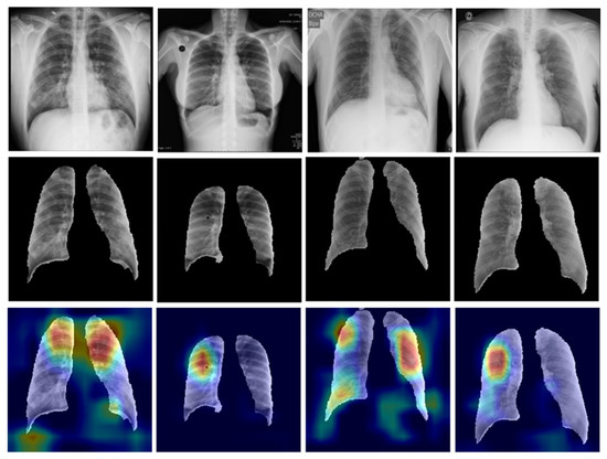 Diagnostics | Free Full-Text | Segmentation-Based Classification Deep Learning Model Embedded ...