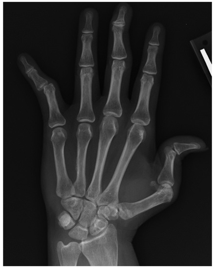 Diagnostics | Free Full-Text | Radiographic Findings of Inflammatory ...