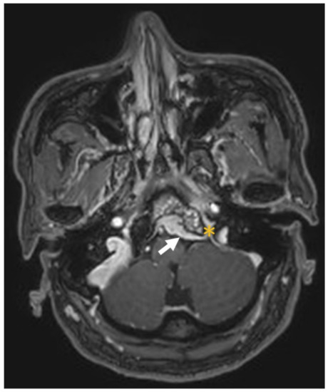 Diagnostics | Free Full-Text | Diagnosis and Treatment of Inflammatory ...