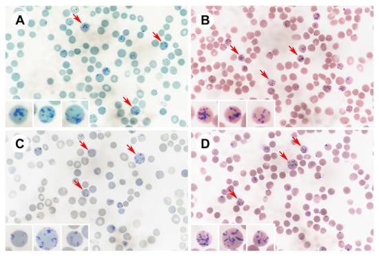 Impact of Staining Methods and Human Factors on Accuracy of Manual ...