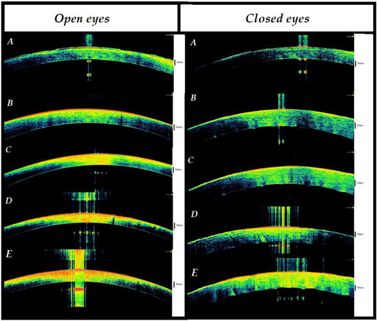 The Influence of Eyelid Position and Environmental Conditions on the ...
