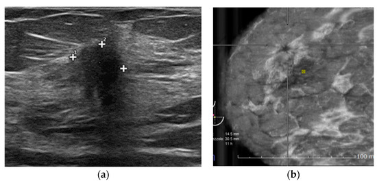 A Prospective Comparative Evaluation of Handheld Ultrasound Examination ...