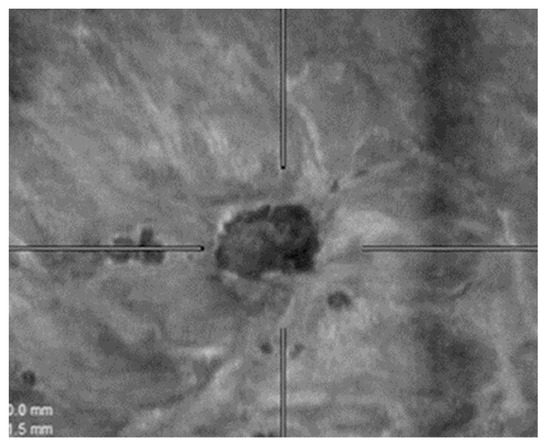 A Prospective Comparative Evaluation of Handheld Ultrasound Examination ...