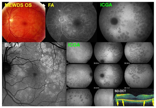Diagnostics | Free Full-Text | Diagnosis, Mechanisms, and ...