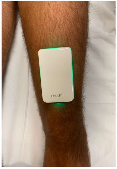 Diagnostics | Free Full-Text | Knee Muscles Composition Using ...