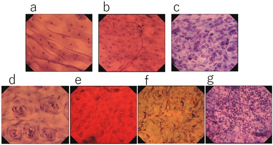 Diagnostics | Free Full-Text | Endocytoscopic Observation of Esophageal ...