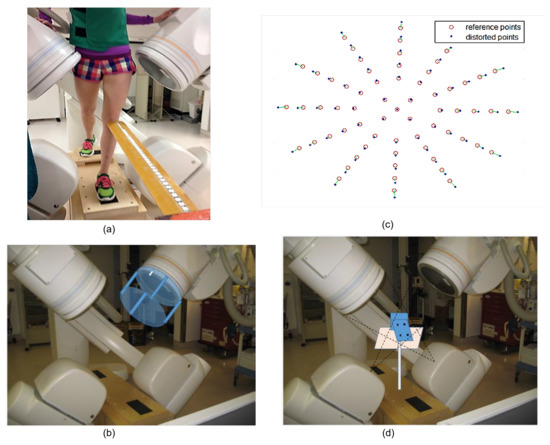Automatic Bone Segmentation from MRI for Real-Time Knee Tracking in ...