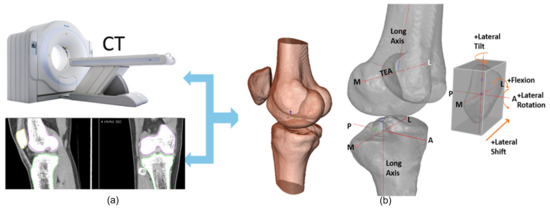 Automatic Bone Segmentation from MRI for Real-Time Knee Tracking in Fluoroscopic Imaging