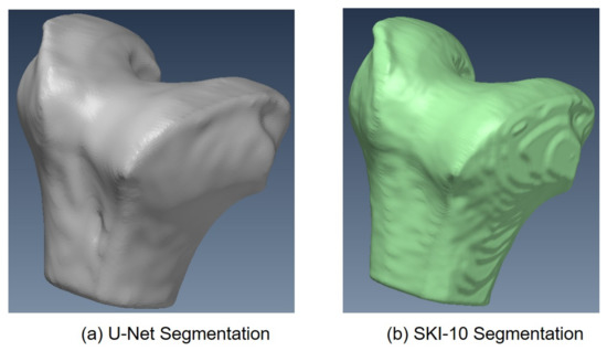 Diagnostics | Free Full-Text | Automatic Bone Segmentation from MRI for ...