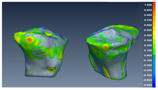 Diagnostics | Free Full-Text | Automatic Bone Segmentation from MRI for ...