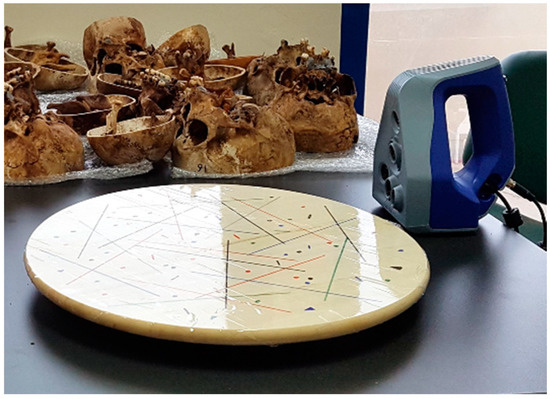 Precision of a Hand-Held 3D Surface Scanner in Dry and Wet Skeletal ...