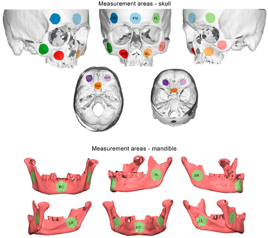 Precision of a Hand-Held 3D Surface Scanner in Dry and Wet Skeletal ...