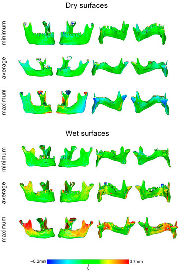 Precision of a Hand-Held 3D Surface Scanner in Dry and Wet Skeletal ...