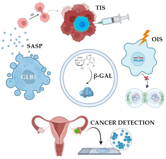 Senescence-Associated β-Galactosidase Detection in Pathology