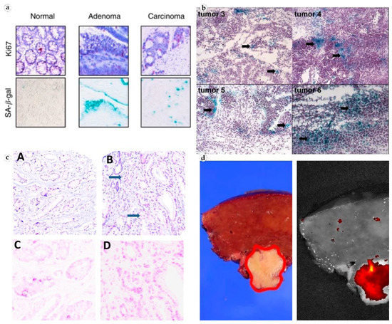 Senescence-Associated β-Galactosidase Detection in Pathology
