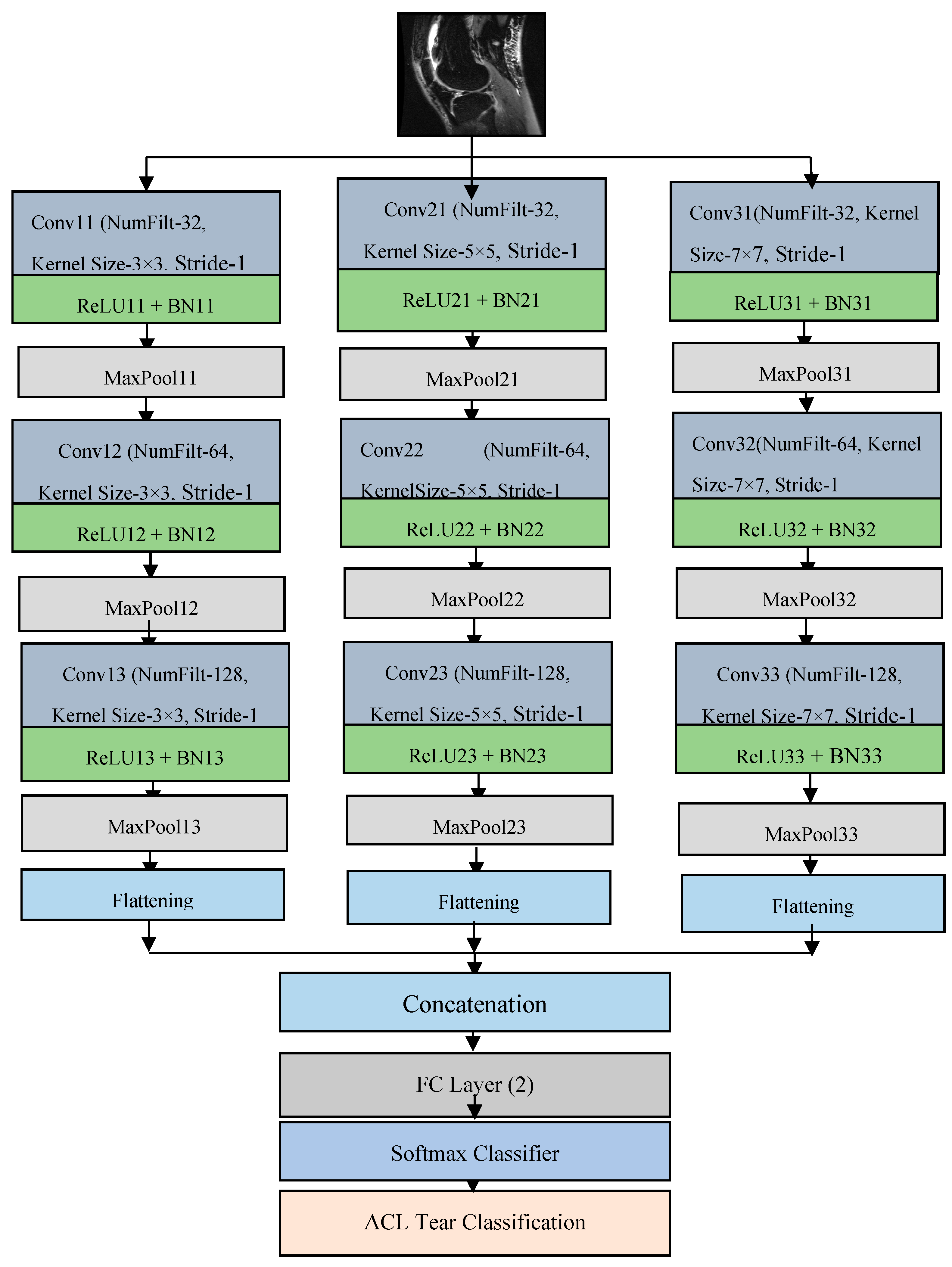 Diagnostics | Free Full-Text | Anterior Cruciate Ligament Tear Detection Based on Deep ...