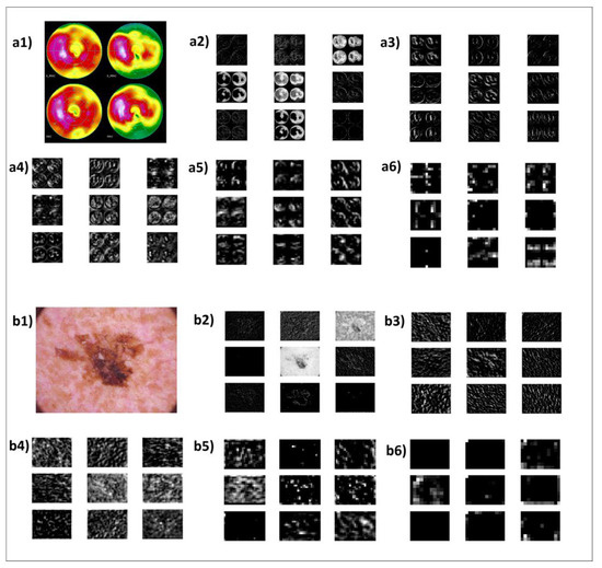 Diagnostics | Free Full-Text | Deep Learning Assessment for Mining ...