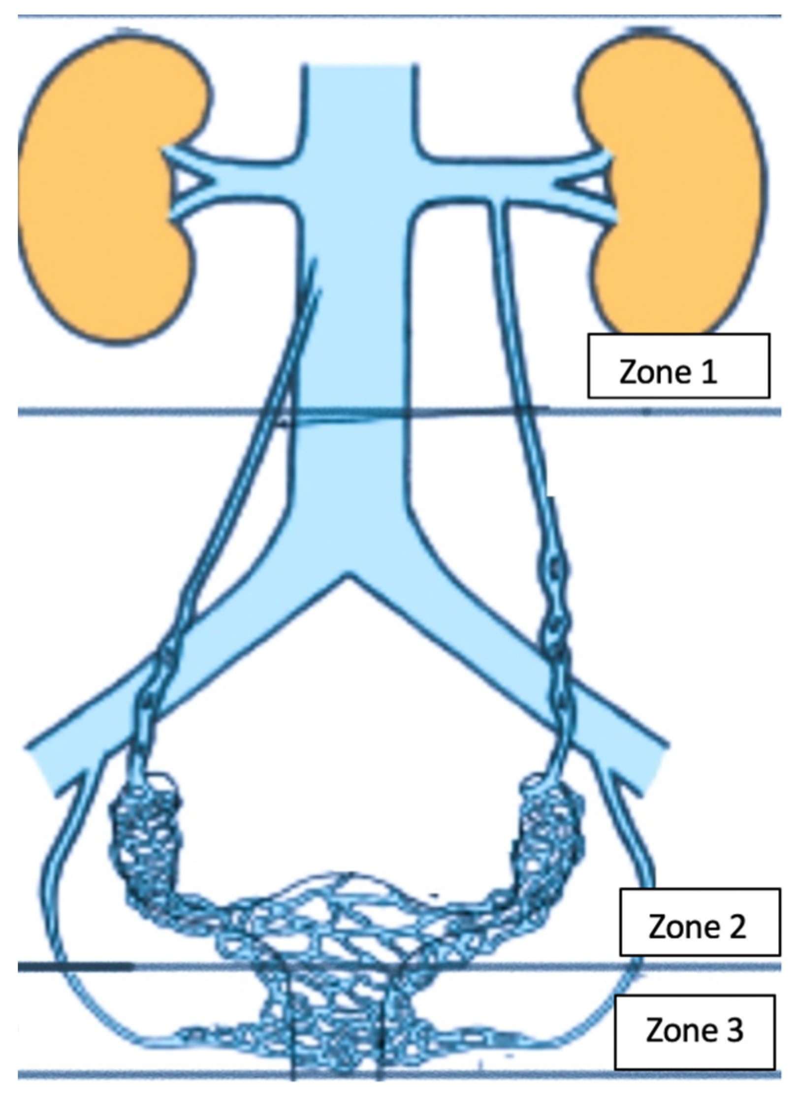 Pelvic Venous Plexus