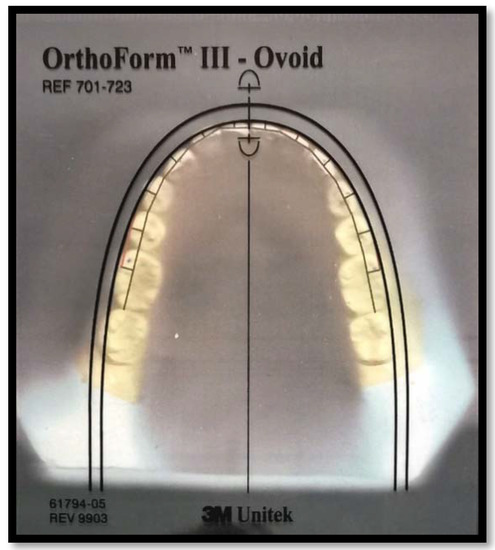 Mandibular Clinical Arch Forms in Iraqi Population: A National Survey