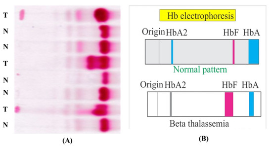 Deep Learning Assisted Automated Assessment of Thalassaemia from ...
