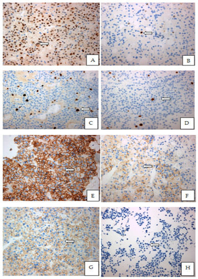 Diagnostics Free Full Text Prognostic Factors For Invasiveness And