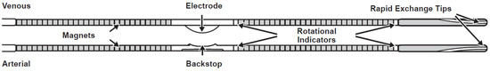 Endovascular Arteriovenous Fistula Creation—Review of Current Experience