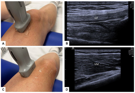 Muscle and Tendon Stiffness of the Lower Limb of Professional ...