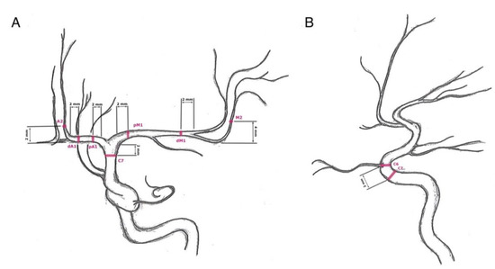 Reference Values of Cerebral Artery Diameters of the Anterior ...