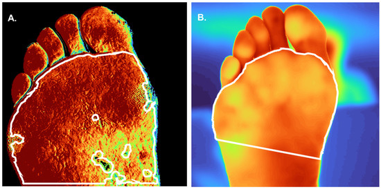 Determination of Changes in Tissue Perfusion at Home with Hyperspectral ...