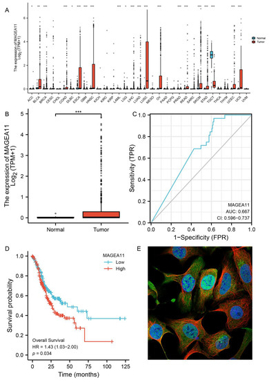 MAGEA11 as a STAD Prognostic Biomarker Associated with Immune Infiltration