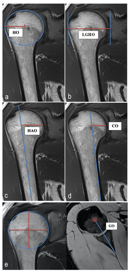 Diagnostics | Free Full-Text | Physiological Offset Parameters of the ...