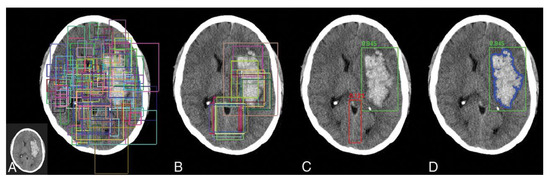 Application of Machine Learning Techniques for Characterization of ...