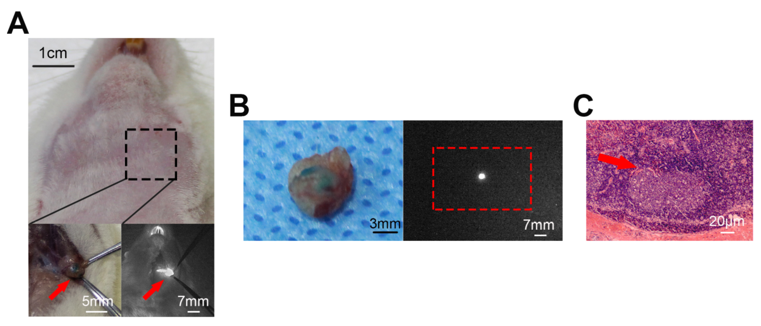 In Vivo Oral Sentinel Lymph Node Mapping by Near-Infrared Fluorescent ...
