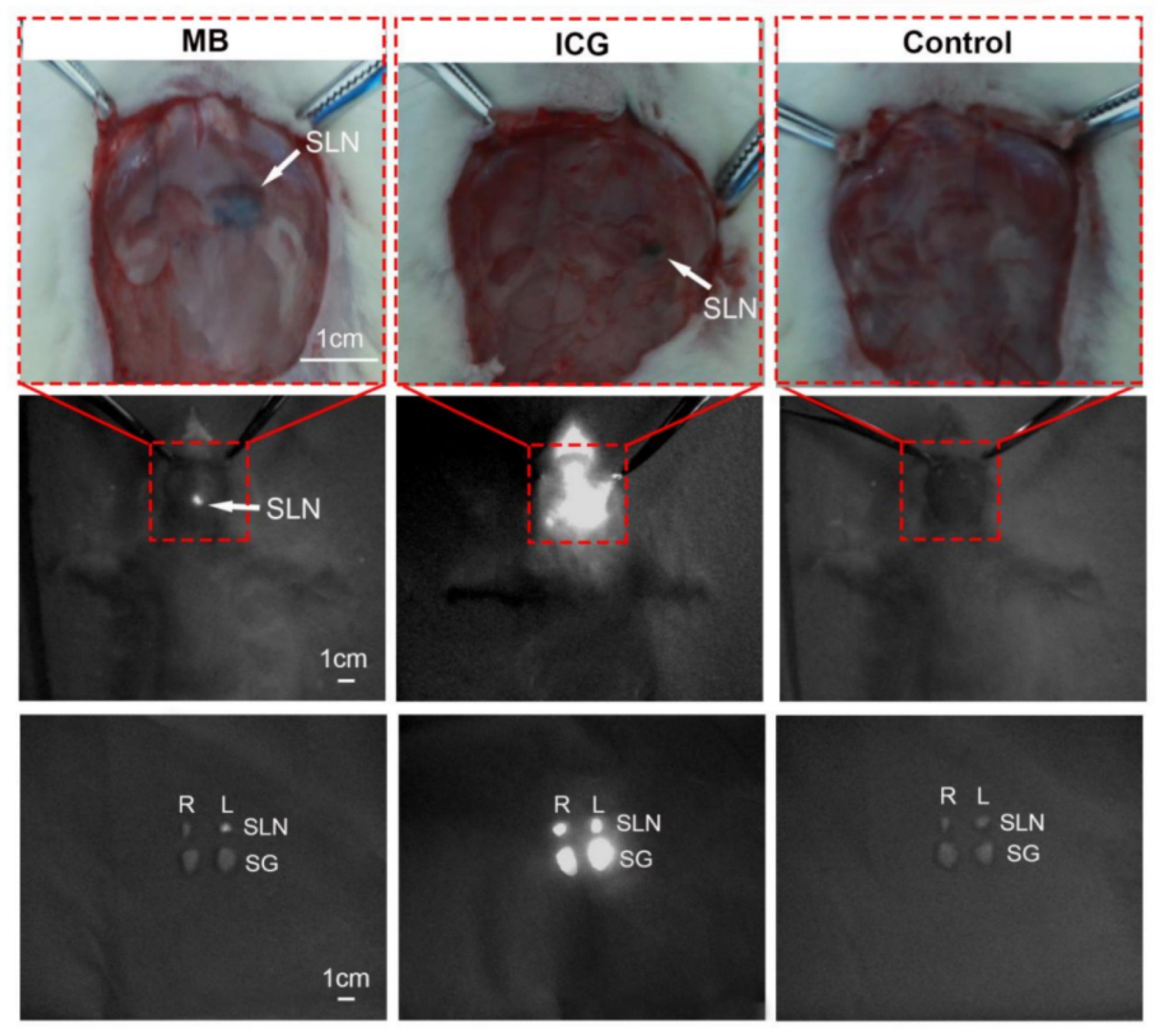 In Vivo Oral Sentinel Lymph Node Mapping by Near-Infrared Fluorescent ...