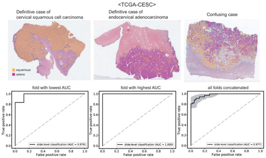 Deep Learning-Based Classification of Uterine Cervical and Endometrial Cancer Subtypes from ...