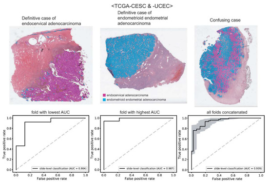 Deep Learning-Based Classification of Uterine Cervical and Endometrial ...