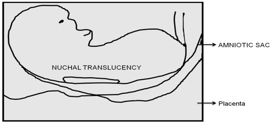 A Novel Framework for Abnormal Risk Classification over Fetal Nuchal ...