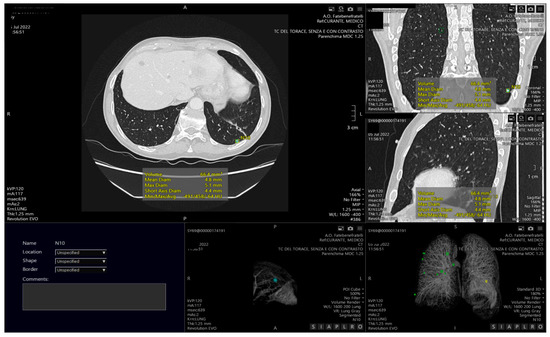 Artificial Intelligence in Lung Cancer Imaging: Unfolding the Future