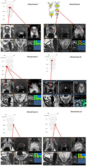 Are Urologists Ready for Interpretation of Multiparametric MRI Findings ...