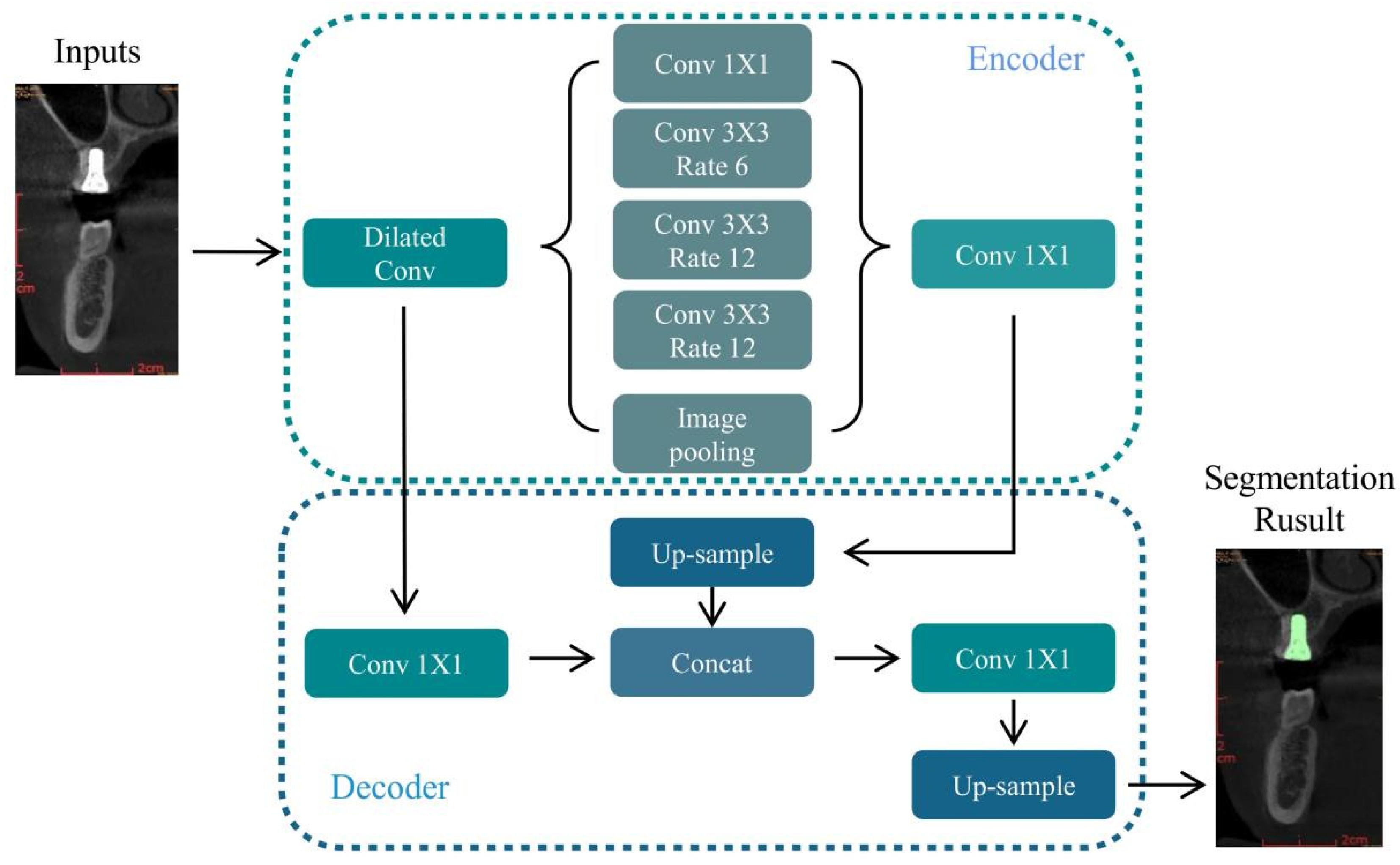 The Construction and Evaluation of a Multi-Task Convolutional Neural Network for a Cone-Beam ...