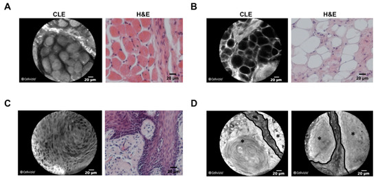 Development, Implementation and Application of Confocal Laser ...