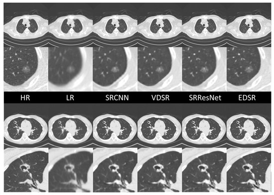 Generating High-Resolution CT Slices from Two Image Series Using Deep ...